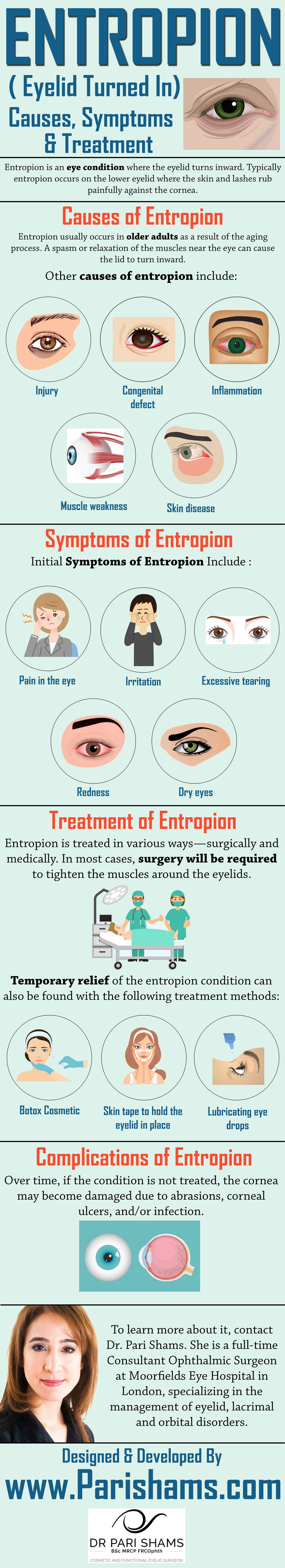 Entropion And Ectropion Causes Symptoms And Treatment Ectropion Boise