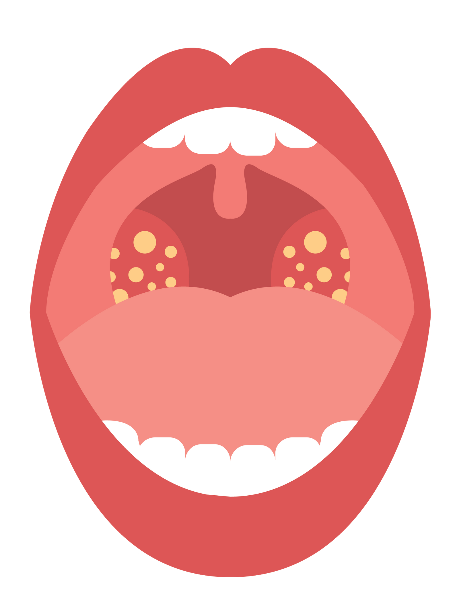 How To Get Rid Of White Spots On Tonsils