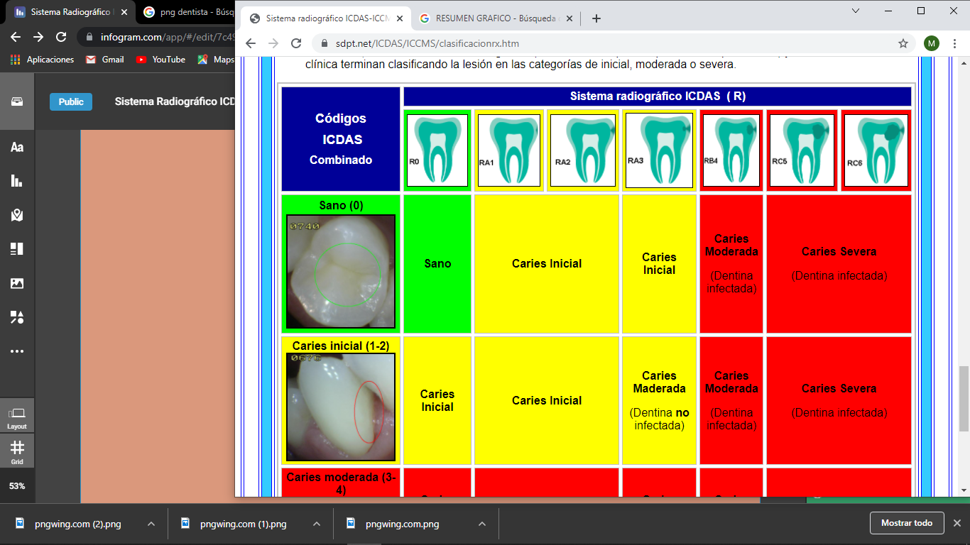 Sistema Radiográfico ICDAS by johana rojas - Infogram